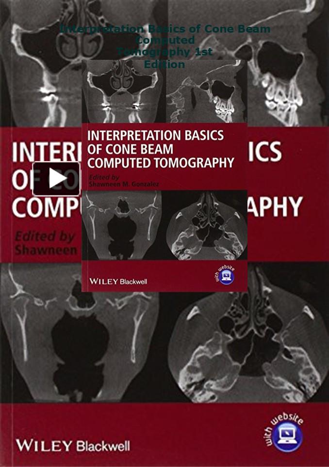 [PDF] ️Download ⚡️ Interpretation Basics of Cone Beam Computed Tomography 1st presentation ...