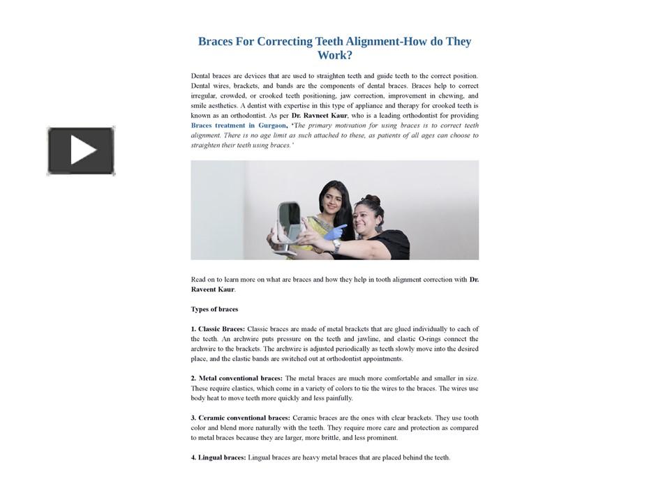 PPT – Braces For Correcting Teeth Alignment-How do They Work? PowerPoint presentation | free to ...