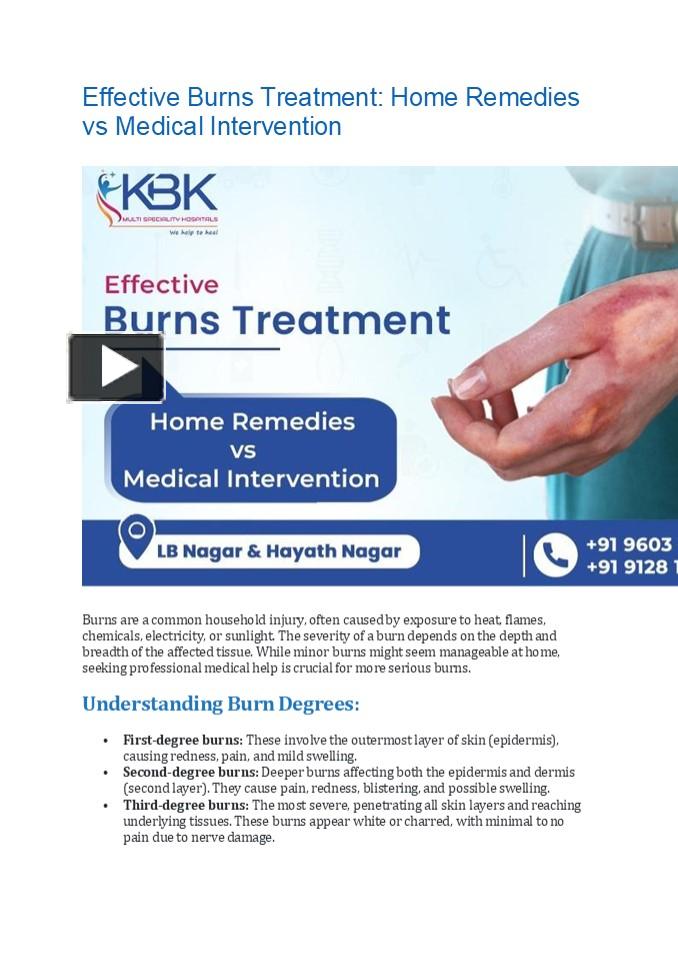 PPT – Best burn injury treatment PowerPoint presentation | free to download - id: 9ba49a-MmY2Z