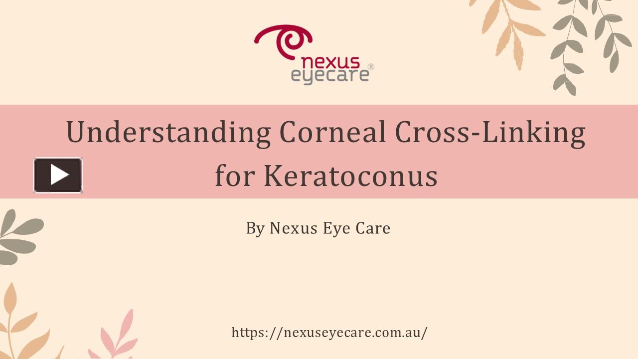 PPT – Understanding Corneal Cross-Linking for Keratoconus PowerPoint presentation | free to ...