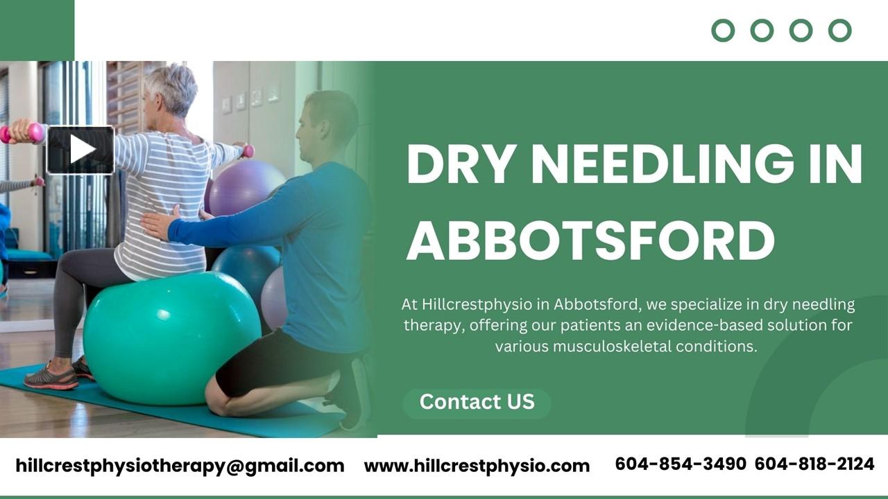 PPT – Dry Needling - Hillcrestphysio PowerPoint presentation | free to download - id: 9c940c-MTMyO