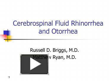 Cerebrospinal Fluid Rhinorrhea and Otorrhea presentation | free to view
