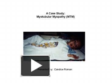 Three different types of MTM presentation | free to view