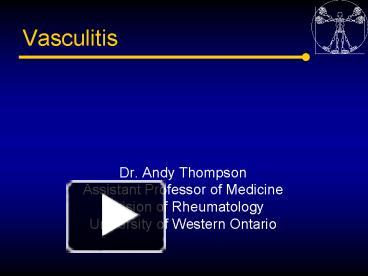 Vasculitis presentation | free to view