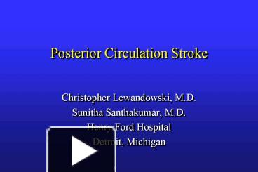 Posterior Circulation Stroke presentation | free to view
