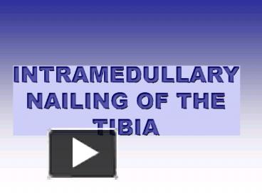 AP and lateral xrays at the level of a tibial presentation | free to view