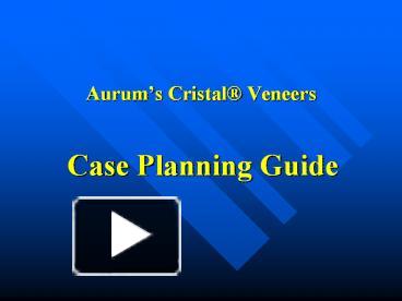 Aurum presentation | free to view