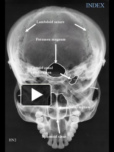 PPT – HN2 PowerPoint presentation | free to view - id: 10152e-ZDc1Z