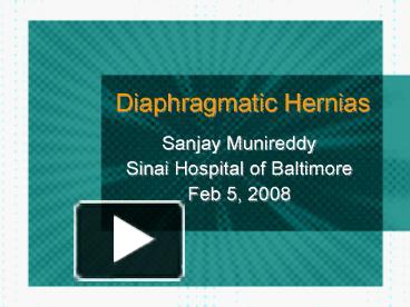 Diaphragmatic Hernias presentation | free to view