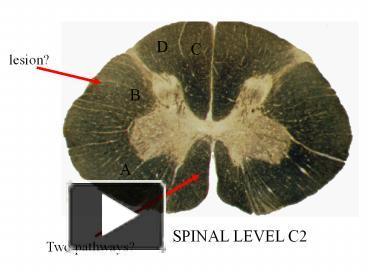 PPT – SPINAL LEVEL C2 PowerPoint presentation | free to download - id ...