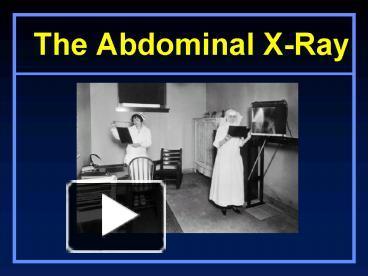 The Abdominal XRay presentation | free to view