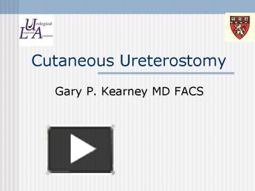 Cutaneous Ureterostomy