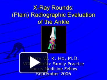 PPT – X-Ray Rounds: (Plain) Radiographic Evaluation of the Ankle ...