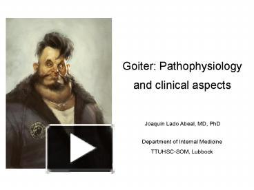 Goiter: Pathophysiology and clinical aspects presentation | free to view