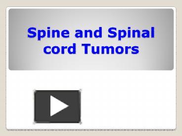 PPT – Spine and Spinal cord Tumors PowerPoint presentation | free to ...