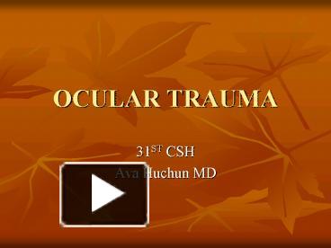 OCULAR TRAUMA presentation | free to view