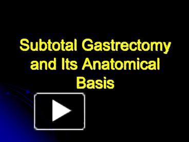 Subtotal Gastrectomy and Its Anatomical Basis presentation | free to view
