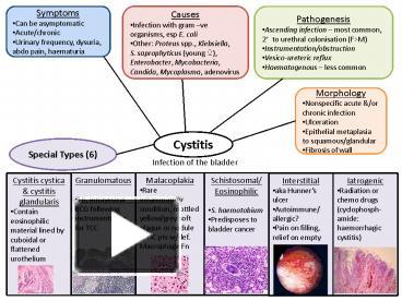 Cystitis presentation | free to view