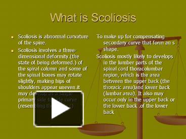 PPT – What is Scoliosis PowerPoint presentation | free to view - id ...