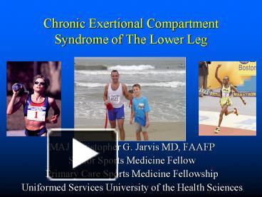 Chronic Exertional Compartment Syndrome of The Lower Leg presentation ...