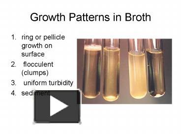 PPT – Growth Patterns in Broth PowerPoint presentation | free to view ...