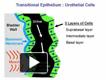 Lumen of Lower Urinary Tract presentation | free to view