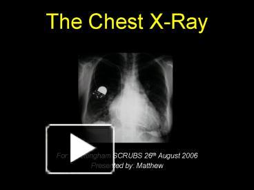 The Chest XRay presentation | free to view