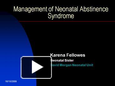 PPT – Management of Neonatal Abstinence Syndrome PowerPoint ...