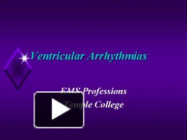 PPT – Ventricular Arrhythmias PowerPoint presentation | free to view ...