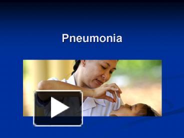 Pneumonia presentation | free to view