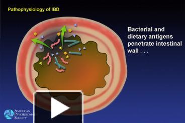 PPT – Pathophysiology of IBD pt. 1 PowerPoint presentation | free to ...