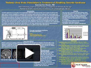 PPT – Konstantin Slavin, MD PowerPoint presentation | free to download ...