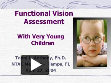 Functional Vision Assessment presentation | free to view