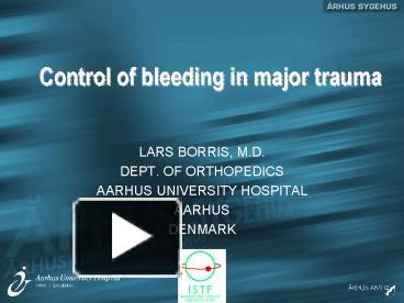 Control of bleeding in major trauma presentation | free to view