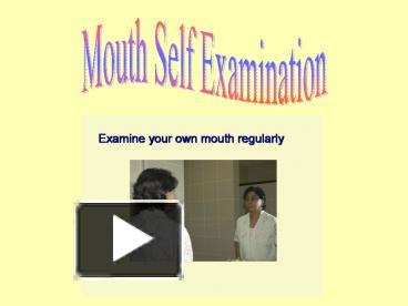 Mouth Self Examination presentation | free to view