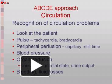PPT – ABCDE approach Circulation PowerPoint presentation | free to view ...