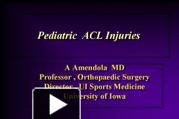Pediatric ACL Injuries presentation | free to view