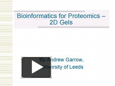 PPT – Bioinformatics for Proteomics 2D Gels PowerPoint presentation ...