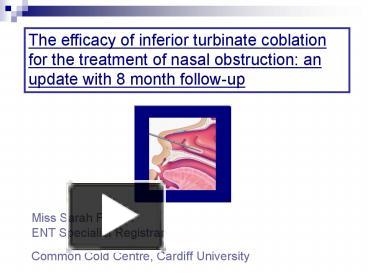 The efficacy of inferior turbinate coblation for the treatment of nasal ...