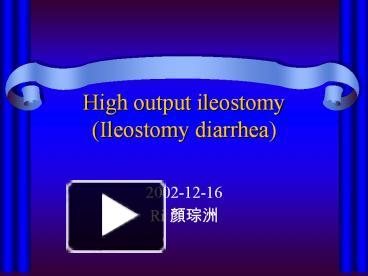 PPT – High output ileostomy (Ileostomy diarrhea) PowerPoint ...