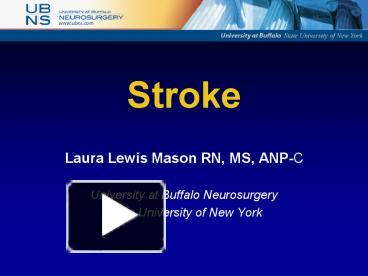 Stroke presentation | free to view