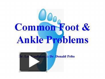 PPT – Common Foot PowerPoint presentation | free to view - id: 12dcdb-YTU3O