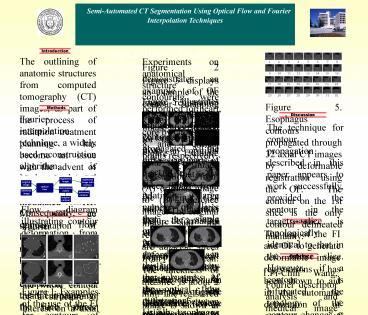 PPT – The outlining of anatomic structures from computed tomography CT ...