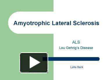 Amyotrophic Lateral Sclerosis presentation | free to view