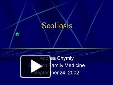 Scoliosis presentation | free to view