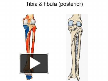Tibia presentation | free to view