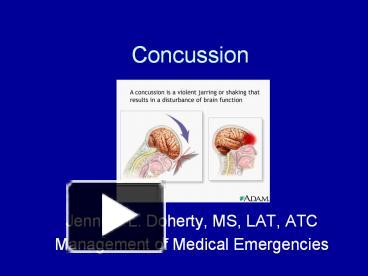 Concussion presentation | free to view