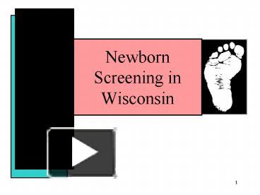 Newborn Screening in Wisconsin presentation | free to view