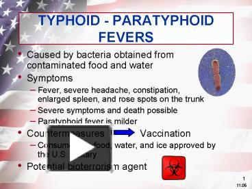TYPHOID PARATYPHOID FEVERS presentation | free to view