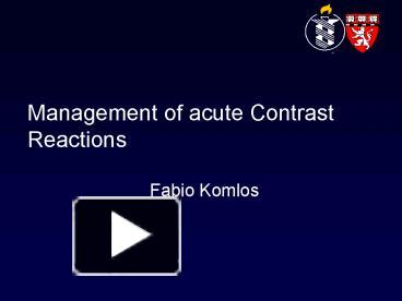 PPT – Management of acute Contrast Reactions PowerPoint presentation ...